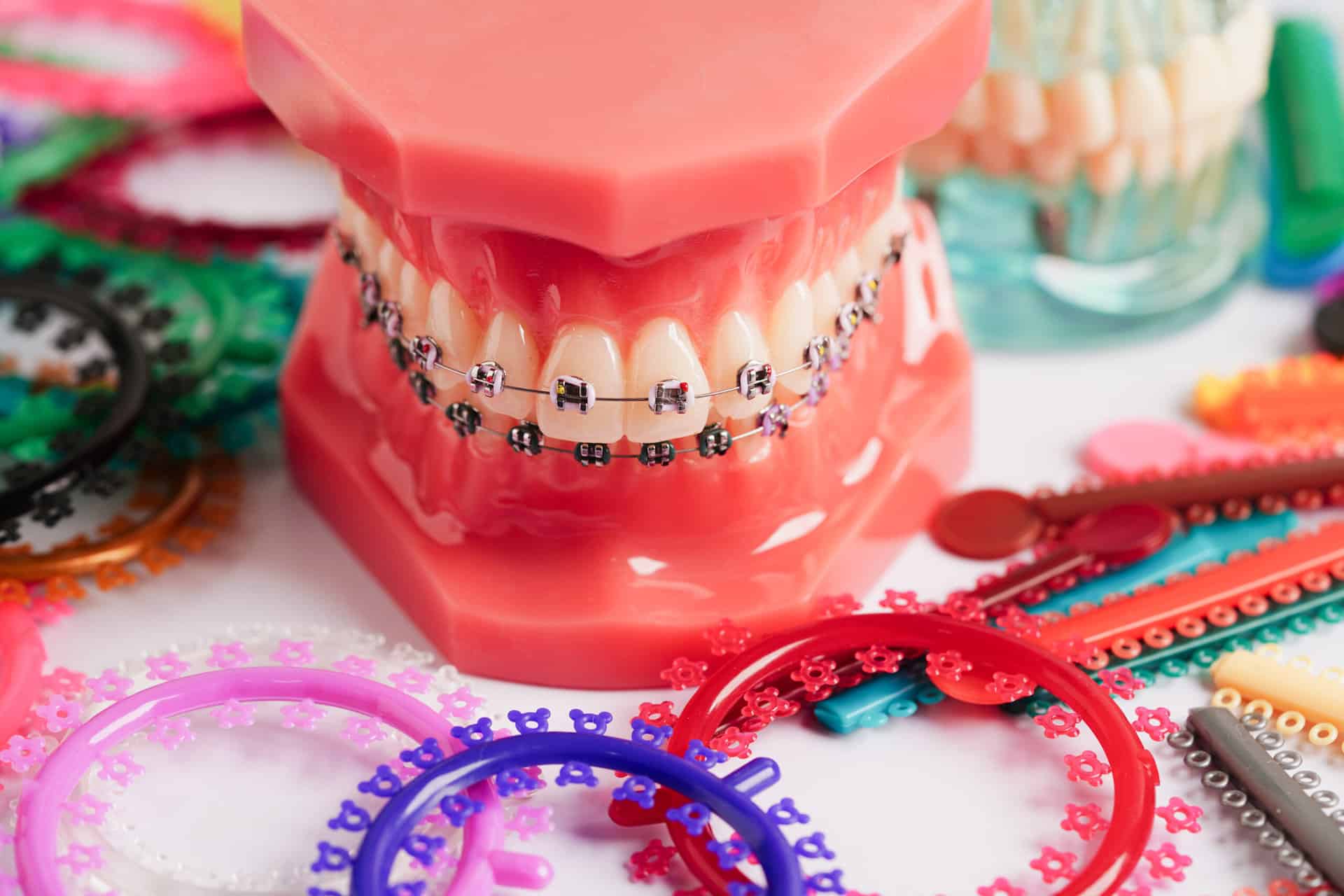 Orthodontic Information | Orthodontic Treatment Guide